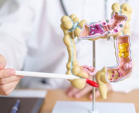 How Colorectal Cancer Is Diagnosed | Screening & Tests Explained