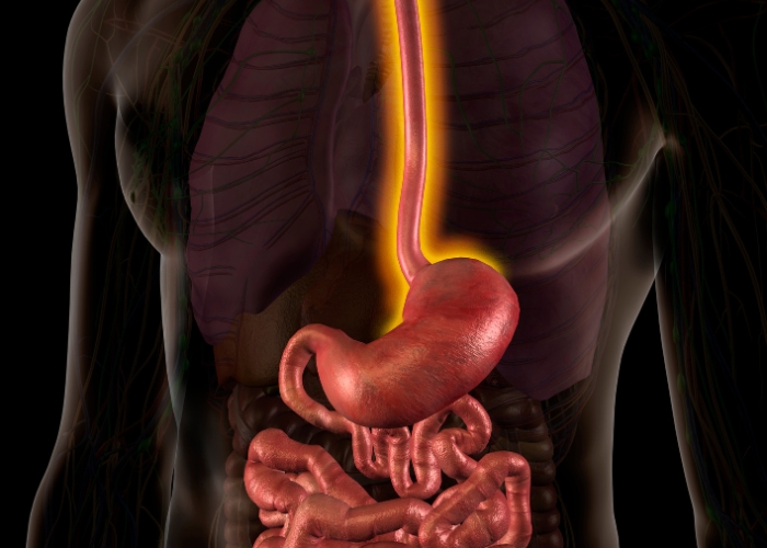 Treatments And Procedures Esophageal Dilation | United Gastroenterology ...
