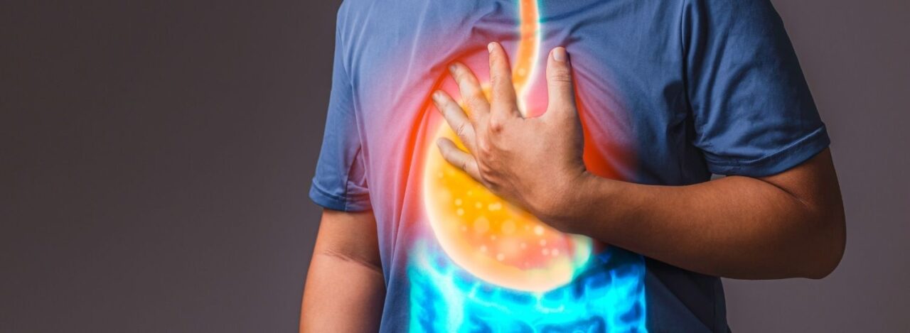 Chest Pain from Acid Reflux: What You Need to Know